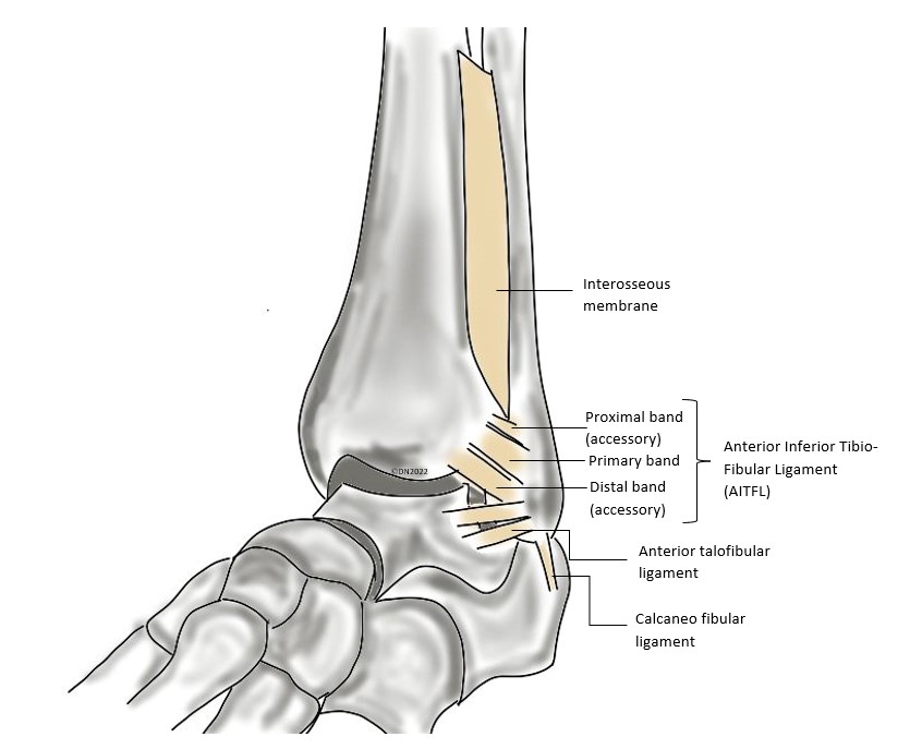 Ankle Syndesmosis Anatomy What Is A High Ankle Sprain 