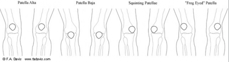 Examination of the Knee